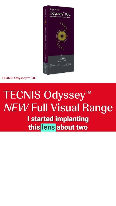 Odyssey Lens (HONEST REVIEW) - YouTube