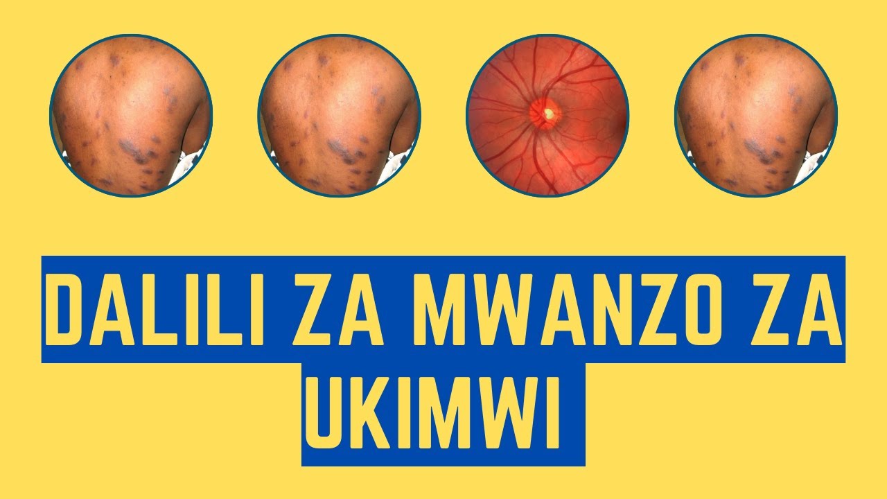 Dalili za mwanzo za UKIMWI, wiki 2: Zimeelezewa kwa kina! - YouTube