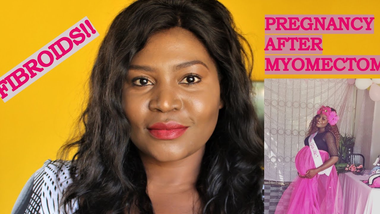 PREGNANCY AFTER MYOMECTOMY|MY EXPERIENCE|ADHESION|TRANSVERSE BREECH ...