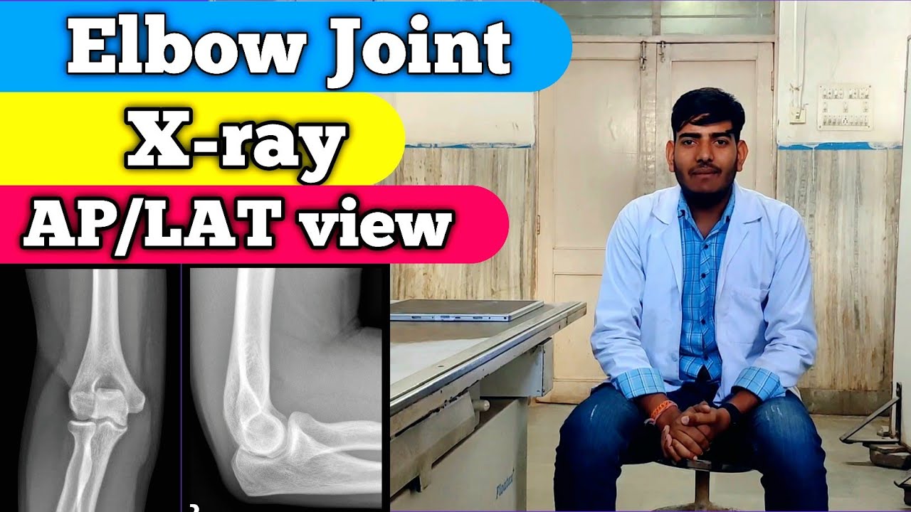 Elbow joint X-ray || AP / LAT view || RADIOGRAPHY - YouTube