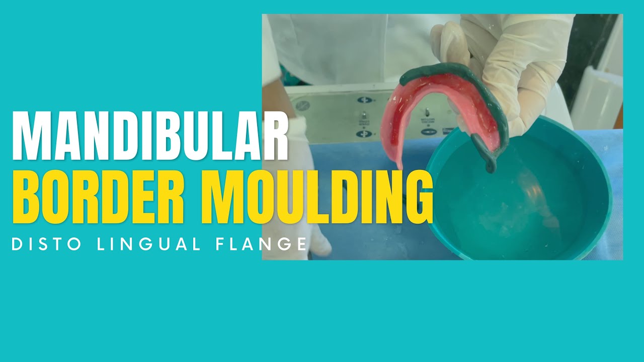 MANDIBULAR BORDER MOULDING - DISTOLINGUAL AREA - YouTube