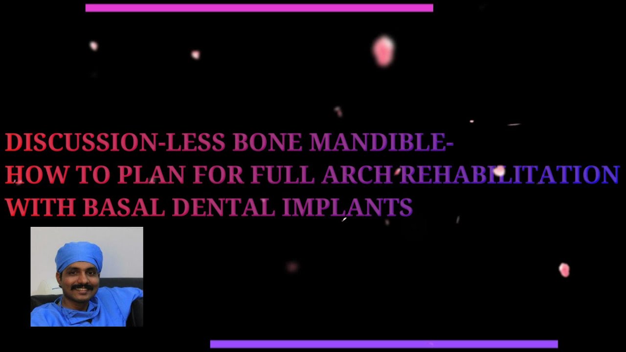 Discussion - less bone mandible. How to plan full arch rehabilitation ...