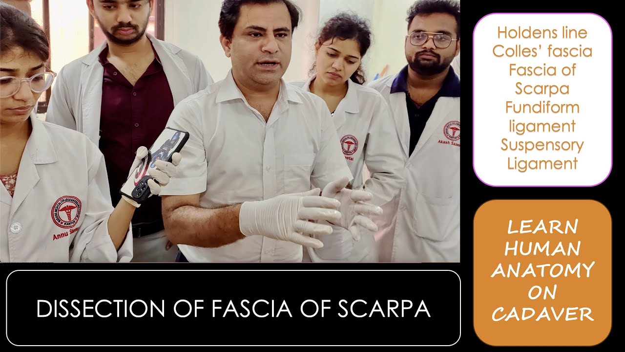Dissection of fascia of Scarpa and it's modifications #clinicalanatomy ...