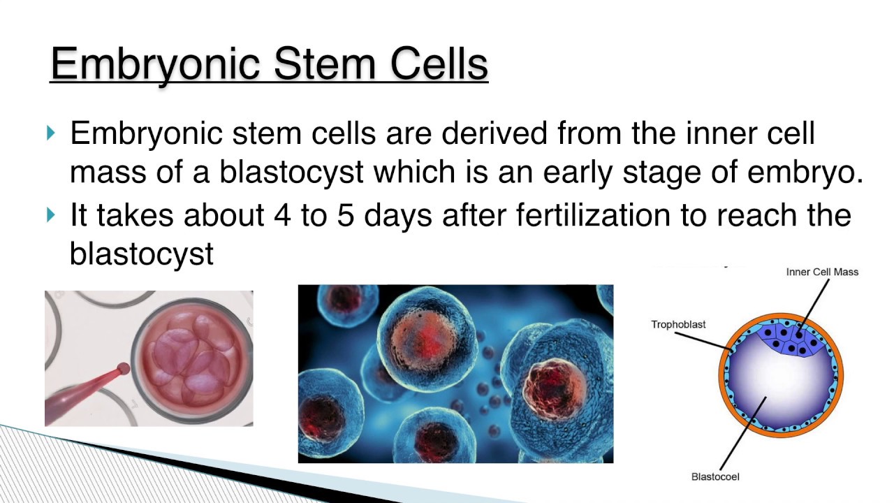 What are the Various sources of Human Stem cell? Physiology | General ...