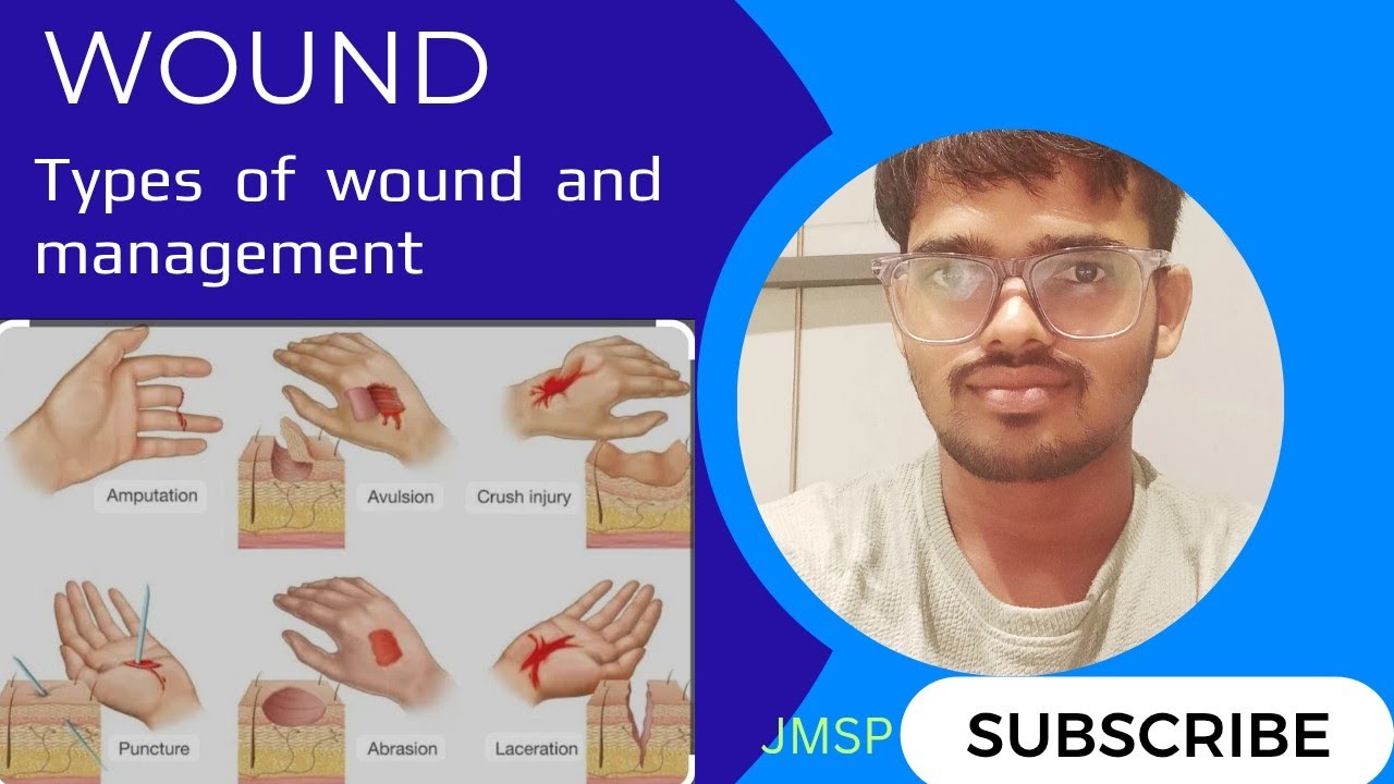 Wound || Types of wound || management of wounds || surgery lecture ...