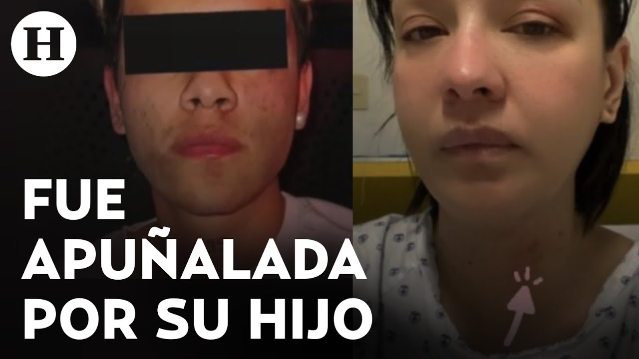 Katya Rodríguez fue atacada por su hijo quien podría ser liberado de ...