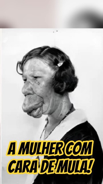 A mulher com cara de mula! #curiosidades #fatoscuriosos #historiass ...