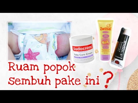 Ruam popok sembuh pake ini? Wajib nonton! #ibudananak - YouTube