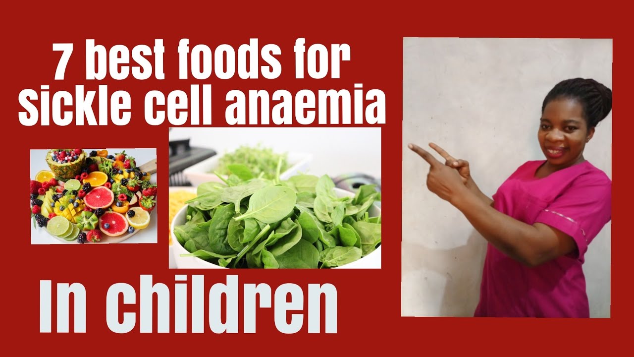7 best foods for a child with sickle cell anaemia - YouTube