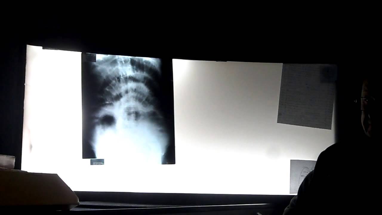 imagen de RX U.D.A. 1/4 - YouTube