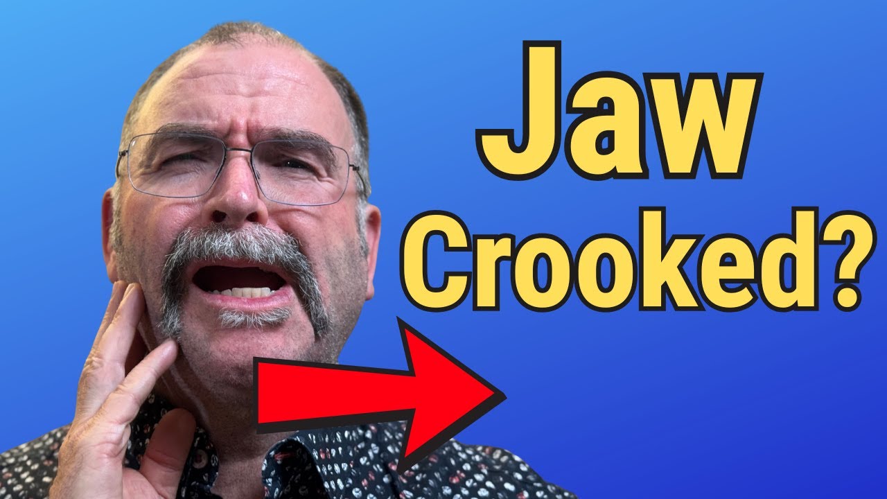 Jaw Deviation | What It Means & How to Fix It - YouTube