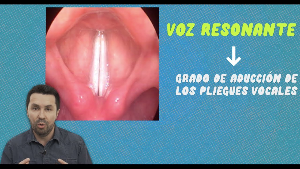 ¿QUÉ ES LA VOZ RESONANTE? - YouTube