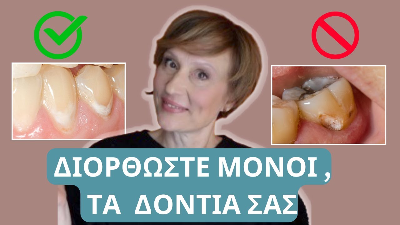 Θεραπεύεται ένα χαλασμένο δόντι, στο σπίτι; - YouTube