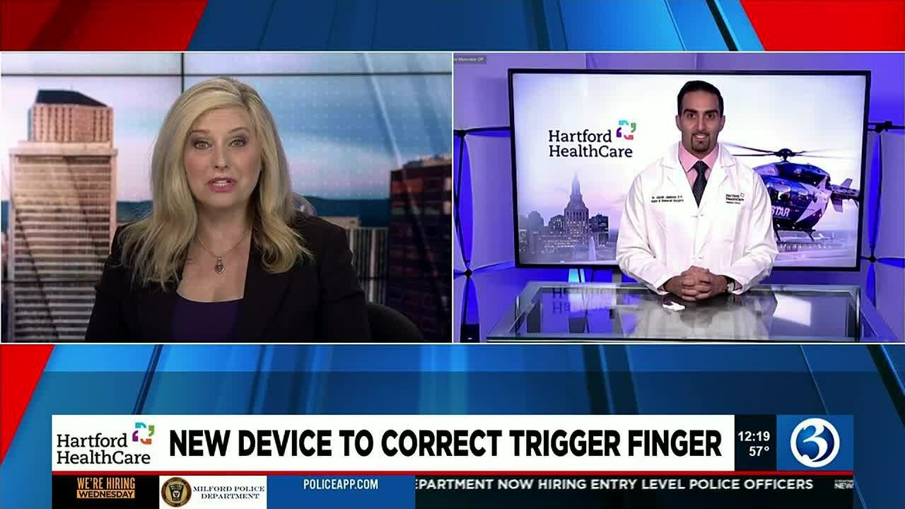 MEDICAL ROUNDS: New device to correct trigger finger - YouTube