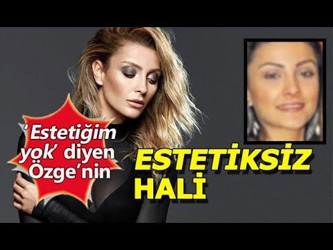 Özge Ulusoy'un estetiksiz hali şok etti