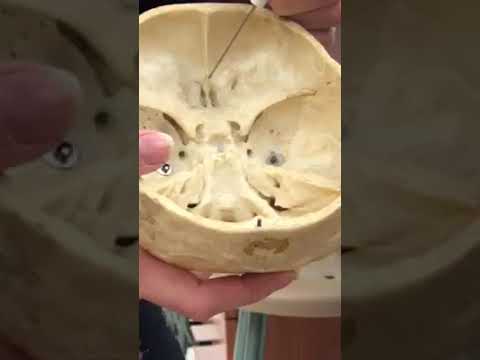 Skull Cribiform plate Christa Galli - YouTube