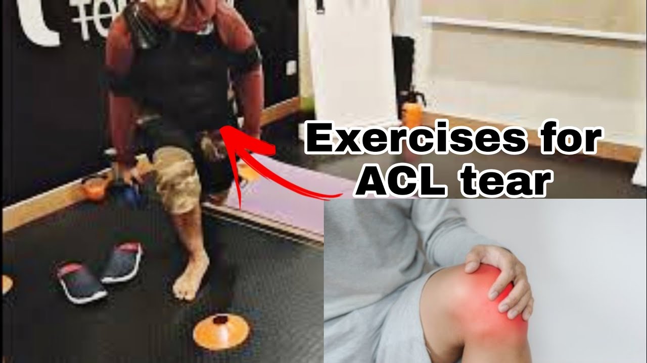 ACL Rehabilitation | ACL reconstruction without surgery | ACL exercises ...