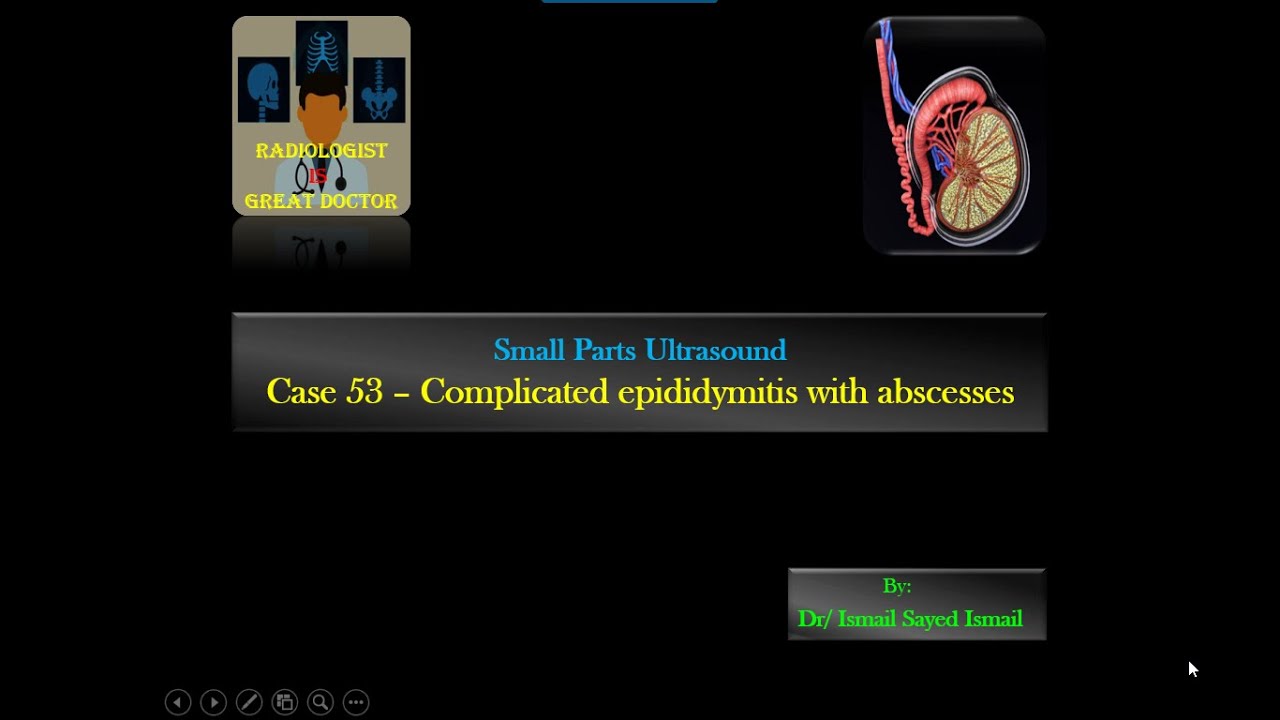 Ultrasound Case 53 - Complicated Epididymitis with Abscesses and ...