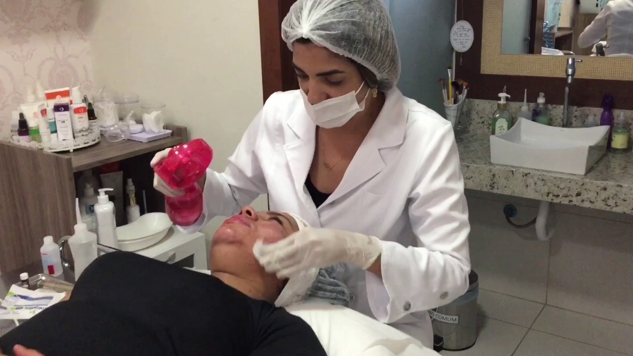 Microagulhamento no tratamento de cicatrizes de acne. - YouTube