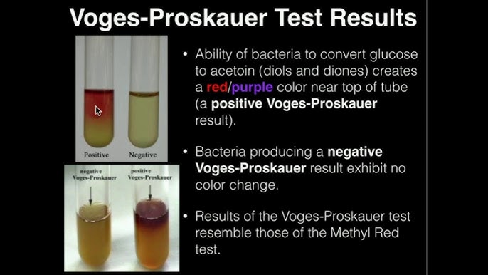 Significance Of IMViC Tests, Principle, Procedure And, 59% OFF Significance Of IMViC Tests, Principle, Procedure And, 59% OFF