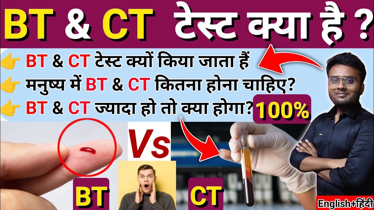 Bt Ct Test In Hindi | Bt Ct Blood Test | Bleeding Time | Clotting Time ...