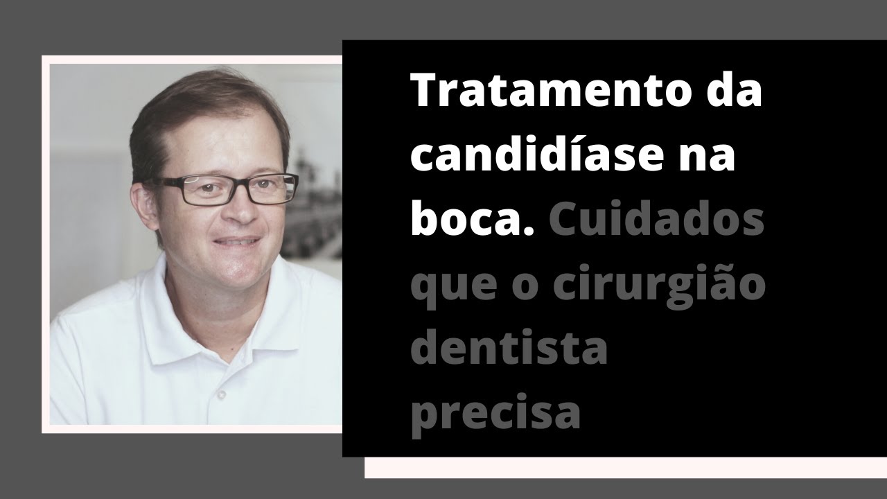 Tratamento da candidíase na boca. Cuidados que o cirurgião dentista ...