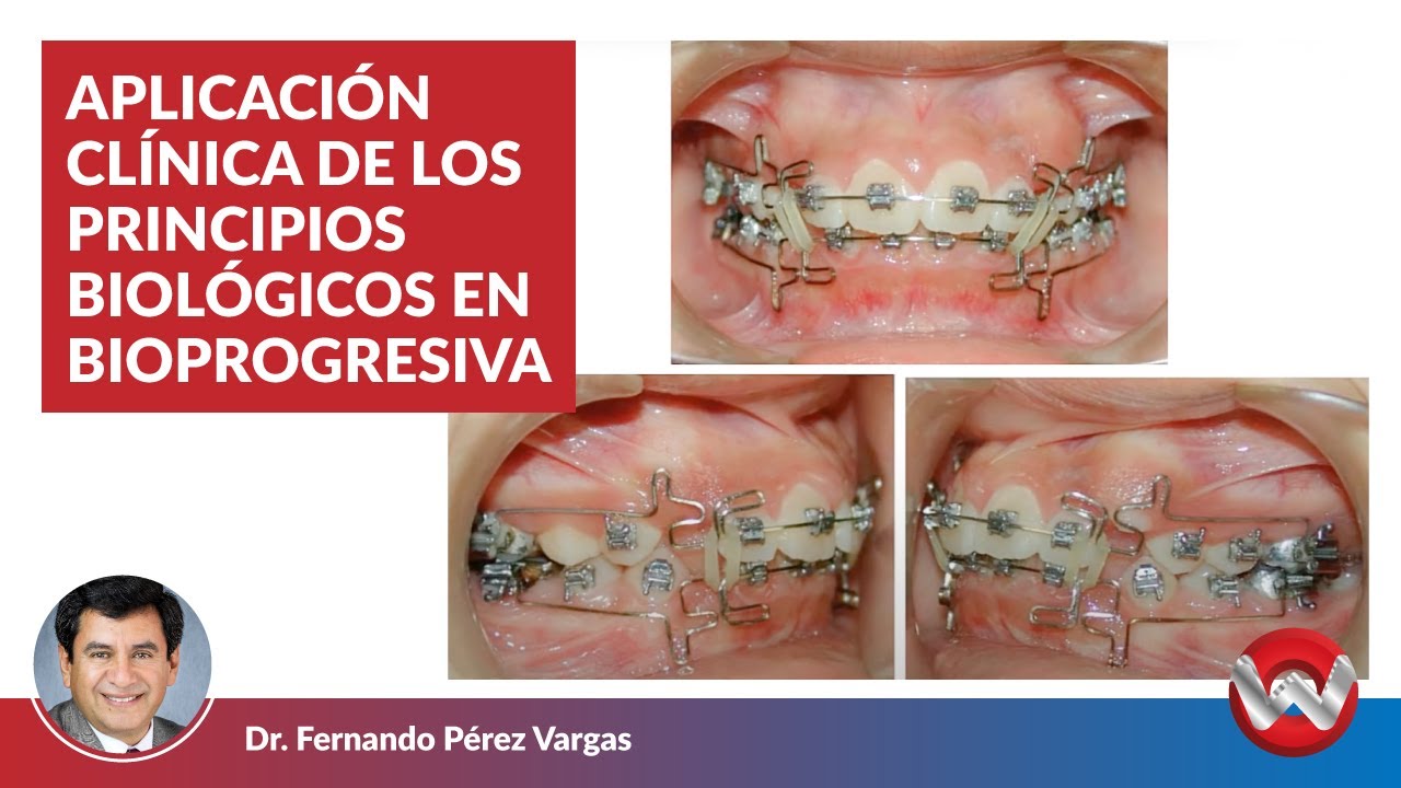 Aplicación clínica de los principios biológicos en Bioprogresiva - YouTube
