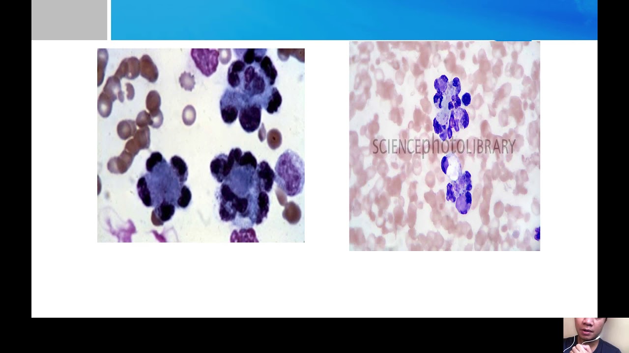 LE CELL PREP LAB DISCUSSION - YouTube