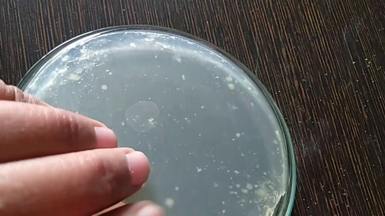 Pour plating and spread plating Colonies| isolation of bacteria from ...