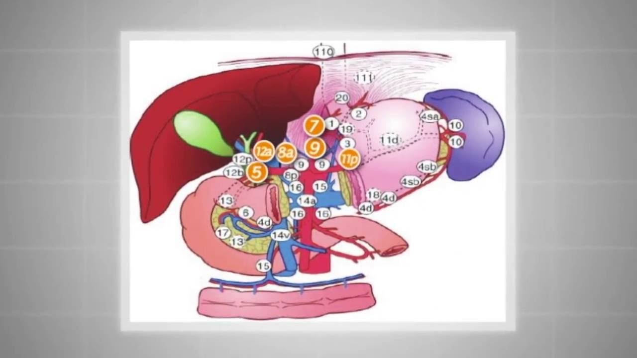 Laparoscopic Total Gastrectomy - YouTube