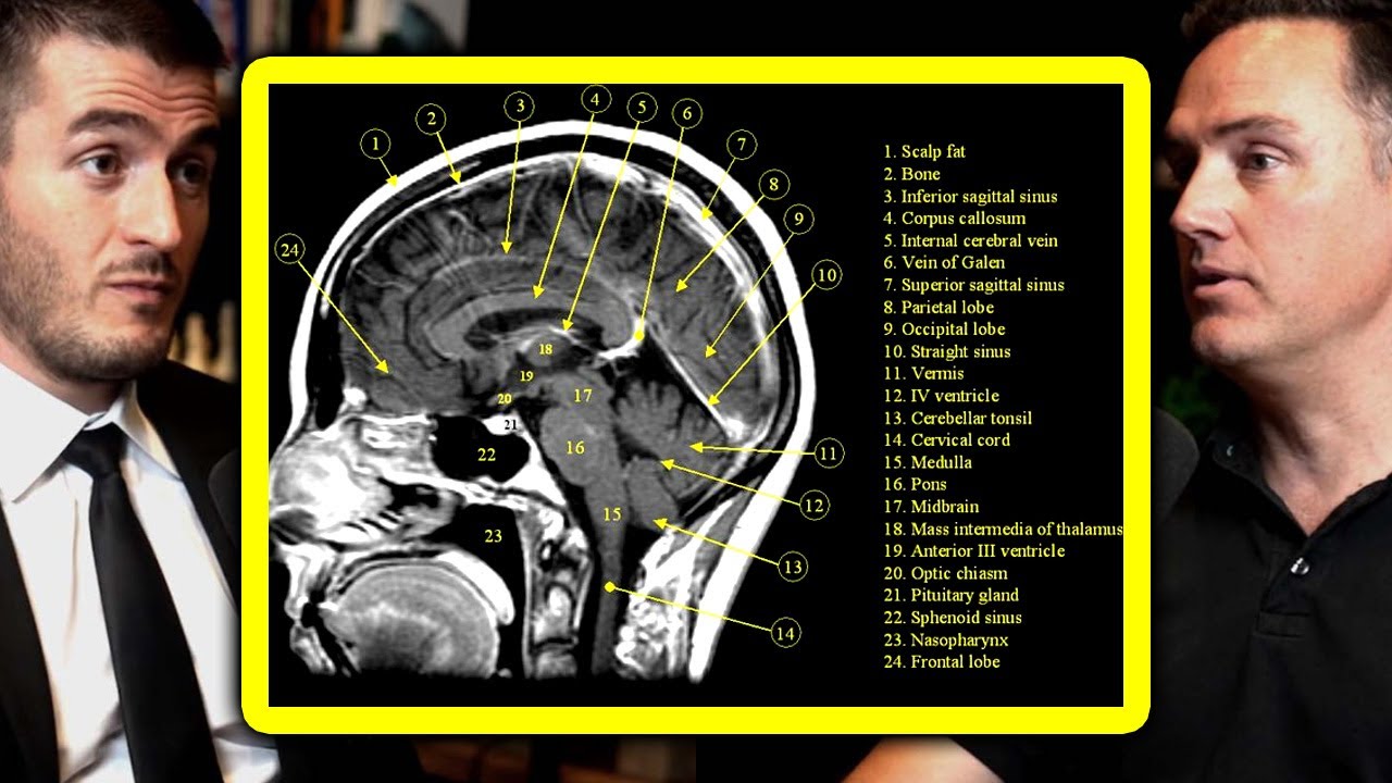 Neurosurgeon explains how the brain works - YouTube