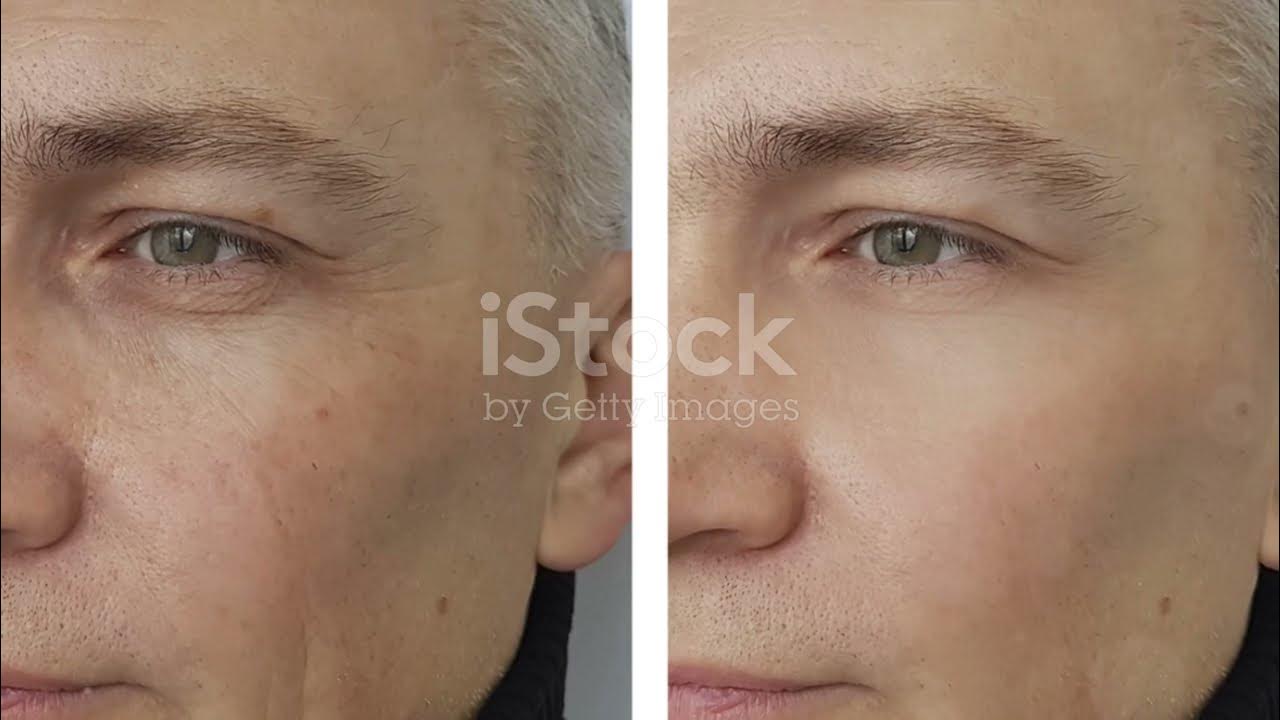 how to mew properly /Mastering Mewing /men - YouTube