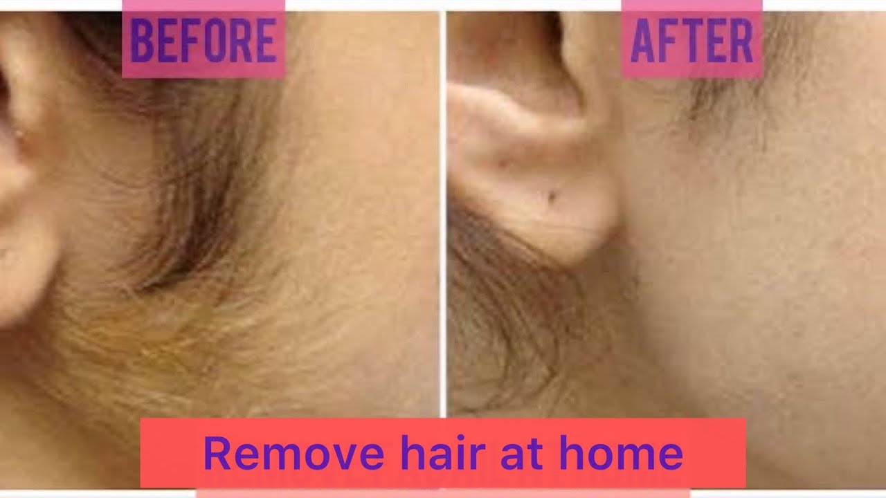 NATURAL HAIR REMOVAL AT HOME | Now remove hair at home | Remove facial ...
