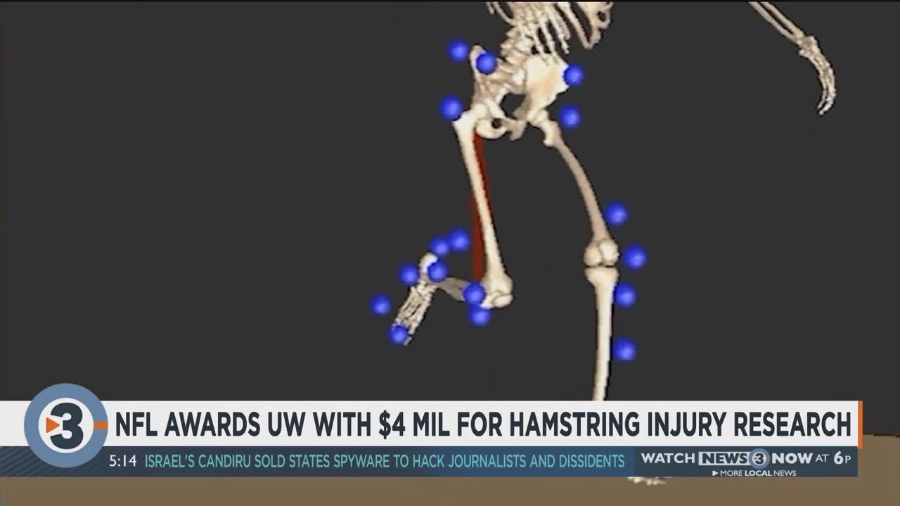 UW researchers awarded $4 million from NFL to lead study on hamstring ...