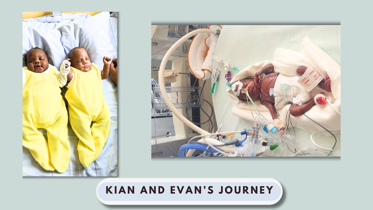 Kian and Evan’s Journey: Born 22.4 weeks. (Micro Preemies) # ...