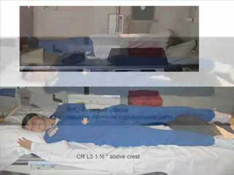 Adult Lumbar Spine-RPO,LPO - YouTube