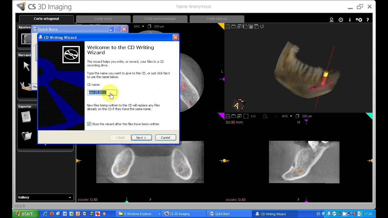 Tutorial CS 3D imaging software. 17-Carestream. Exportar - Grabar el ...