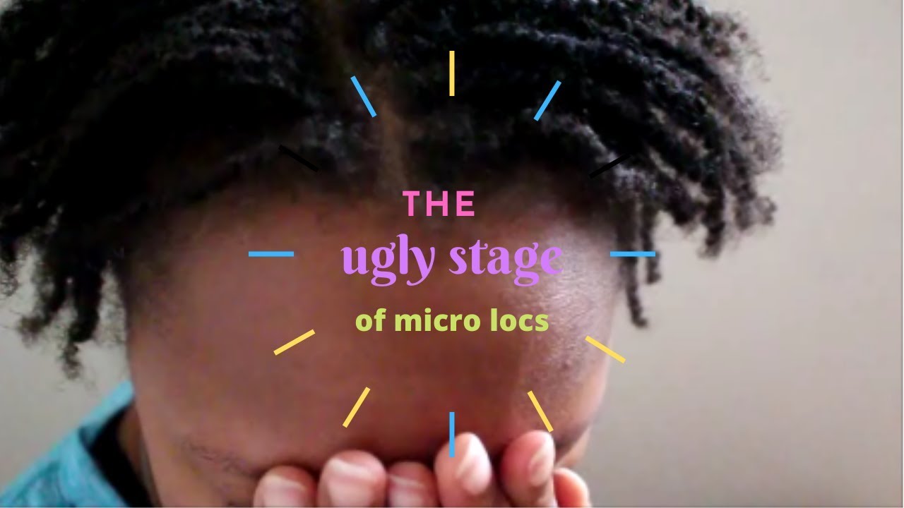 (334)MICRO LOCS: THE UGLY STAGE - YouTube