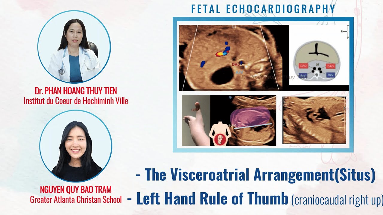 THE VISCEROATRIAL ARRANGEMENT (SITUS) - LEFT HAND RULE OF THUMB | FETAL ...