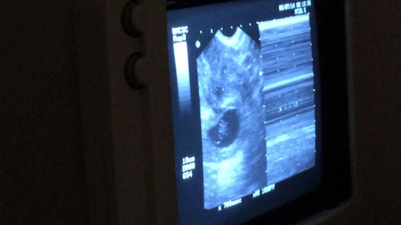 Our baby bunso 06/07/2014 - YouTube