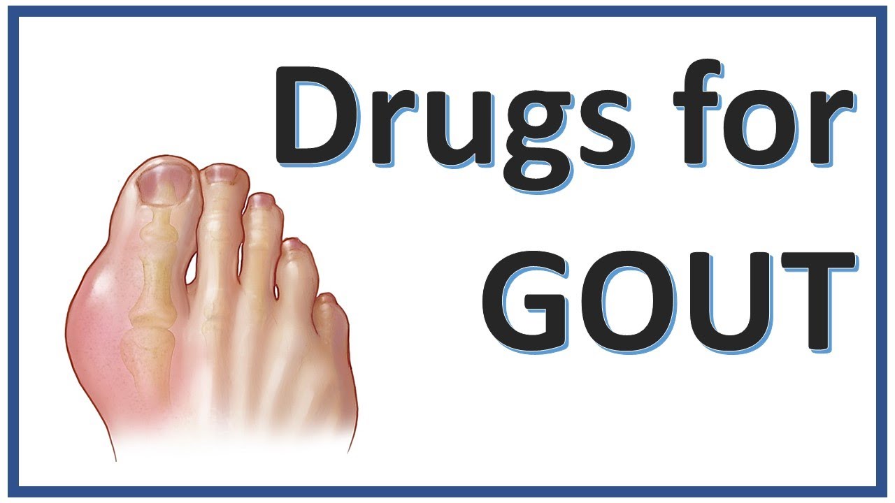Management of GOUT | Acute Gout | Chronic Gout | Management - YouTube