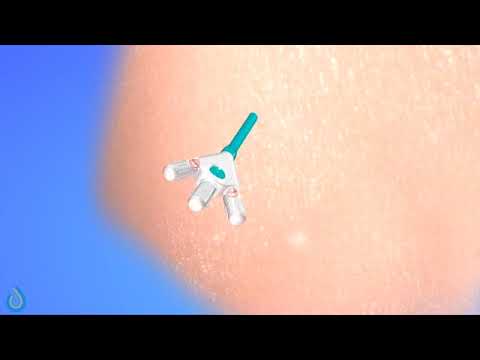 ConvertX Biliary Stent Animation - YouTube