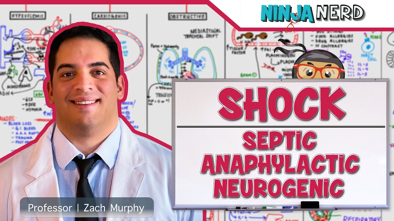 Sepsis Cascade Made Easy