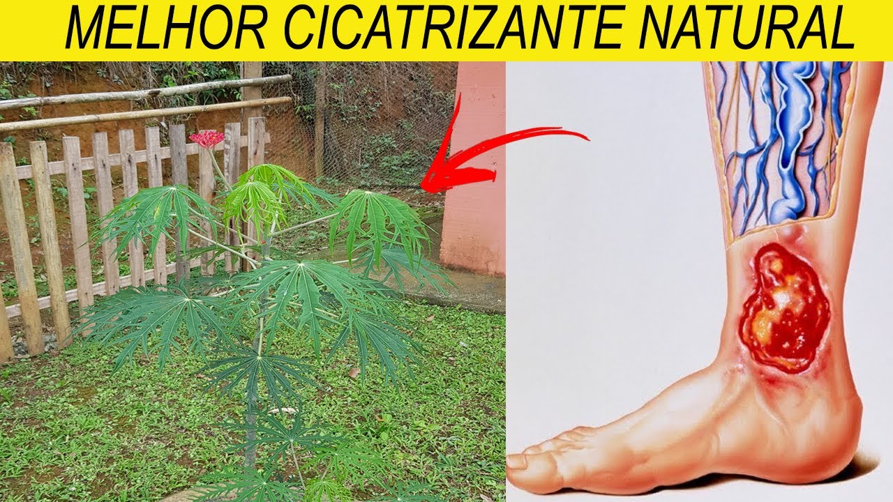 ATENÇÃO! Essa Planta Medicinal é um PODEROSO Cicatrizante Natural ...