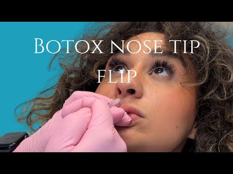 Nose Slimming and Tip Lift with Botox - YouTube