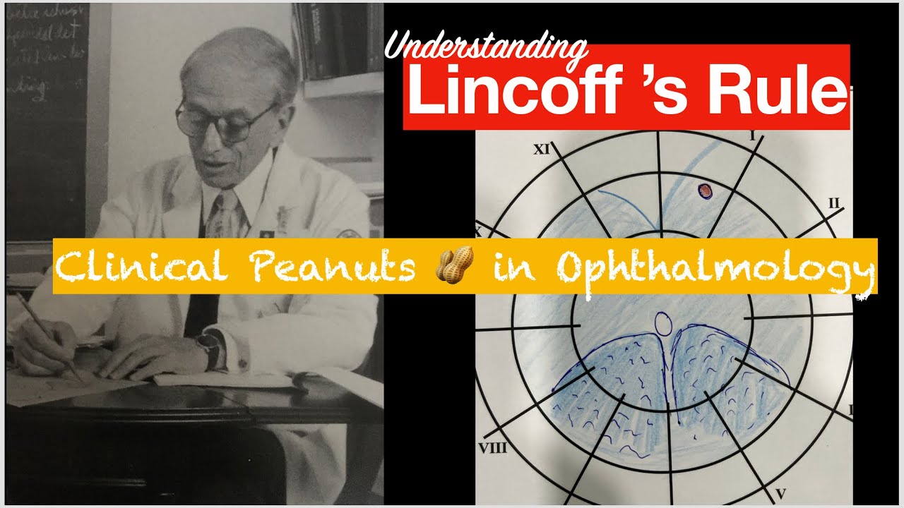 Clinical Peanuts 🥜 - Understanding Lincoff’s rule for localising break ...