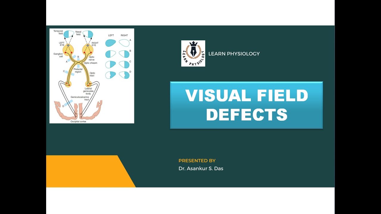 Visual Field Defects - YouTube