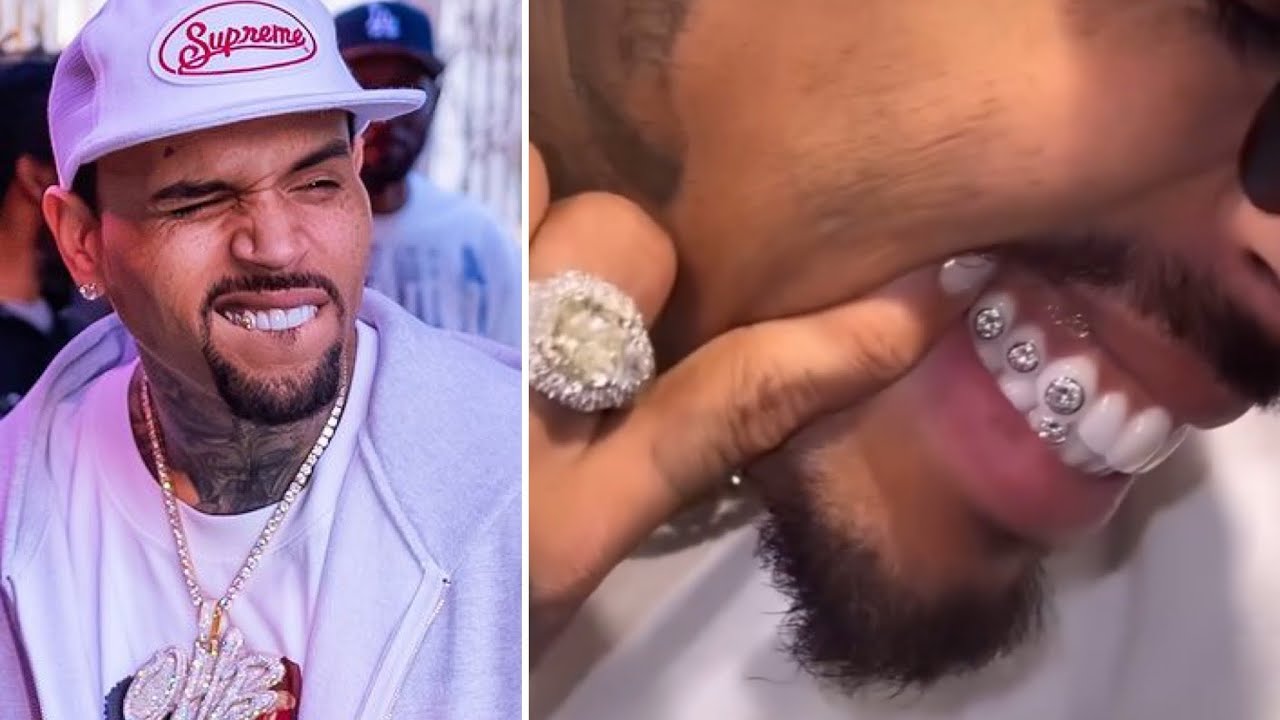 Chris Brown Shows Diamonds On His Teeth And His Jewelry (Very Rich CB ...