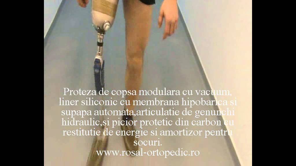 Proteza de coapsa modulara cu vacuum, probe de mers - Rosal Ortopedic ...
