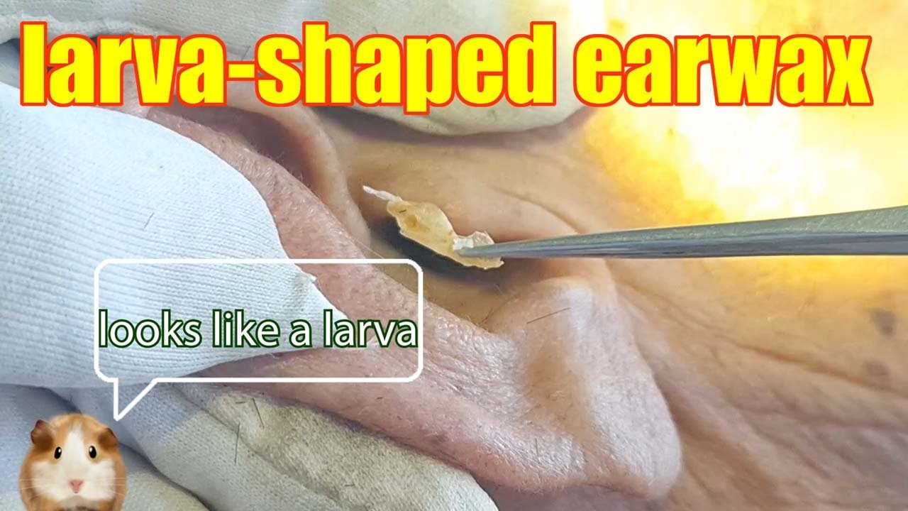 larva-shaped earwax | Looks like a larva cute | ear cleaning with super ...